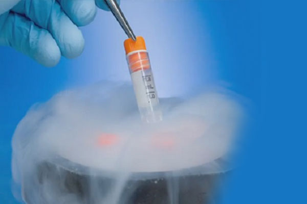 Egg freezing Dallas | Oocyte Cryopreservation Dallas | Gynecologist